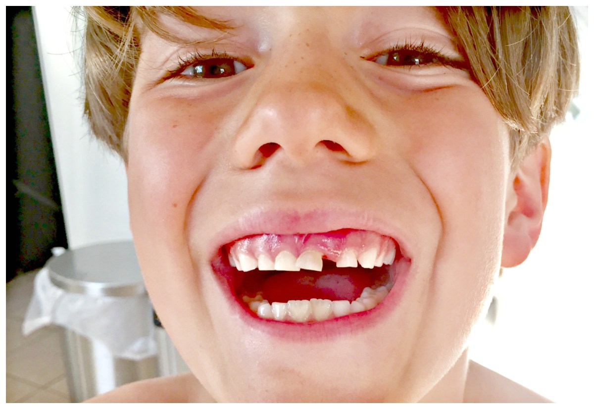 The wiggly tooth that drove everyone crazy – Heather's Handmade Life